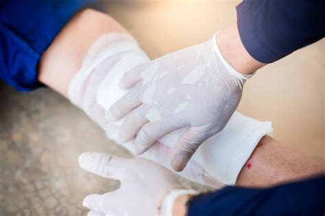 Hemorragia Qué Es Principales Tipos Y Qué Hacer Tua Saúde