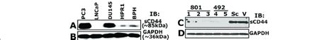 Characterization Of Stable Cd44 Knockdown Cell Lines A Western Blot