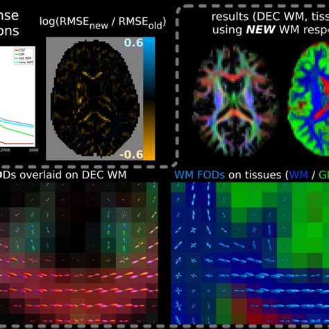 Pdf Improved White Matter Response Function Estimation For 3 Tissue Constrained Spherical