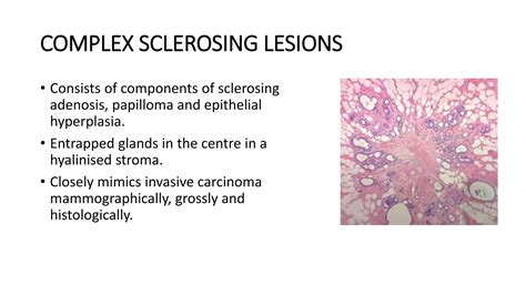 Normal And Malignant Cytology Of Breast Cytology Ppt