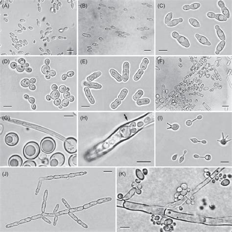 1 Various Forms Of Asexual Reproduction A Polar Budding On A Narrow Download Scientific