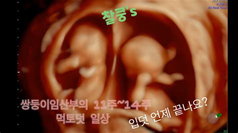 쌍둥이임산부11주~14주까지 먹토덧일상폴레드픽셀오프화이트언박싱고양이태교 Youtube