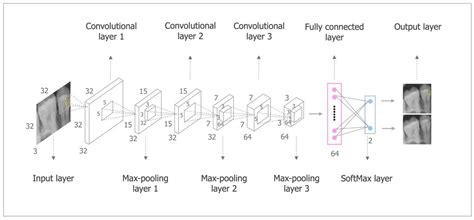 Detecting Proximal Caries On Periapical Radiographs Using Convolutional Neural Networks With