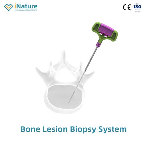 Bone Cancer Biopsy Manufacturer For Bone Cancer Biopsy Inature