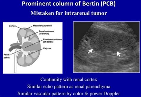 Renal Parenchyma