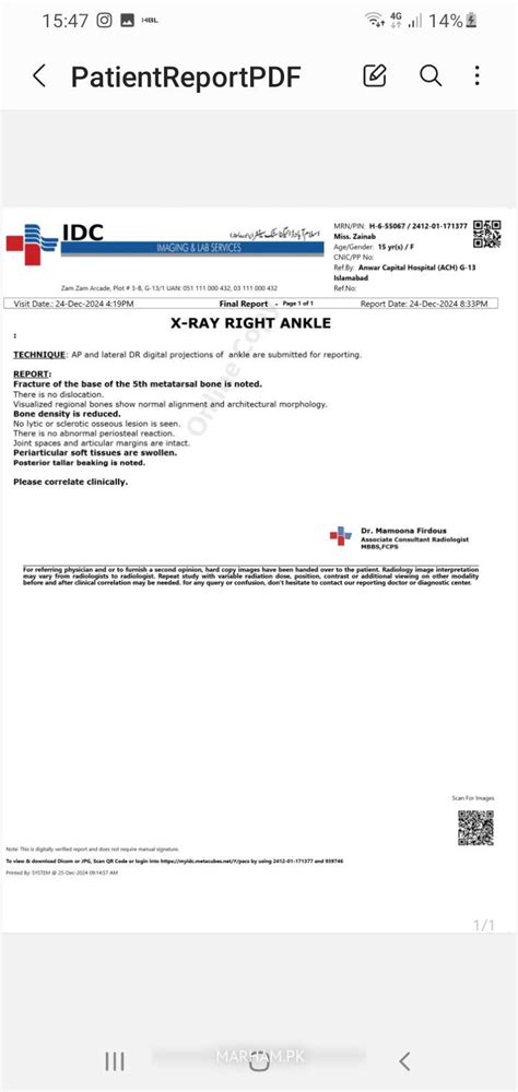 Ask A Orthopedic Surgeon Online For Ankle Injury