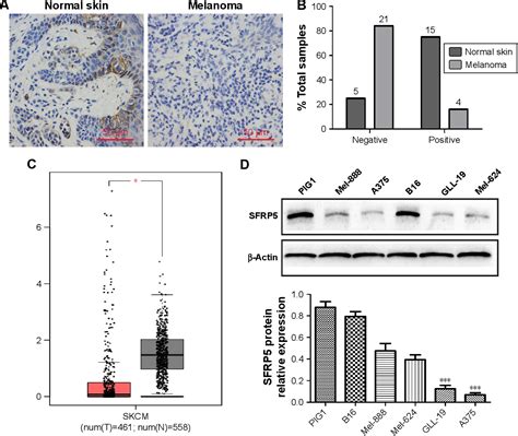 Table 1 From Sfrp5 Inhibits The Migration And Invasion Of Melanoma