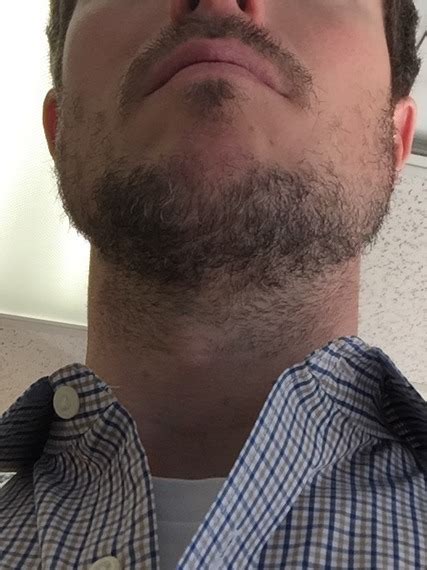 41 Y O First Time Beard Starting At 3 Weeks Beard Board