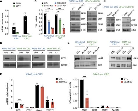 JCI Insight The EMT Factor ZEB Paradoxically Inhibits EMT In BRAF Mutant Carcinomas