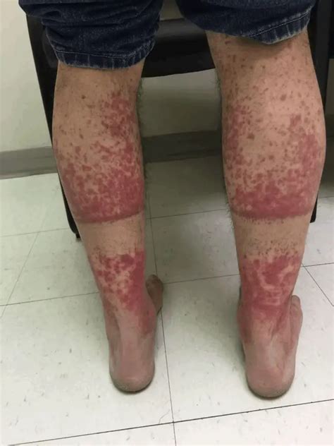 What Your Skin Could Be Telling You About Hidden Health Issues