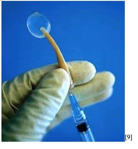 Em 3am Bartholins Abscess Emdocs