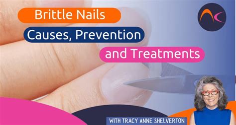 Unhas quebradiças Causas prevenção e tratamento NailKnowledge