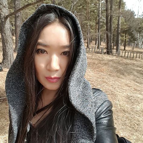 Конкэ дент шүдний эмнэлэг 🦷 АВАГДДАГГҮЙ ХИЙМЭЛ ШҮД 🤩Риббонд туузан утас ашиглан хажуугийн 2