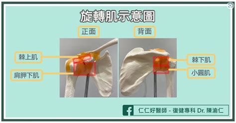 手舉高肩膀疼痛無力側睡壓肩膀劇痛當心旋轉肌撕裂 華人健康網 專業即時優質的健康新聞及資訊分享平台業即時優質的健康新聞及資訊分享平台