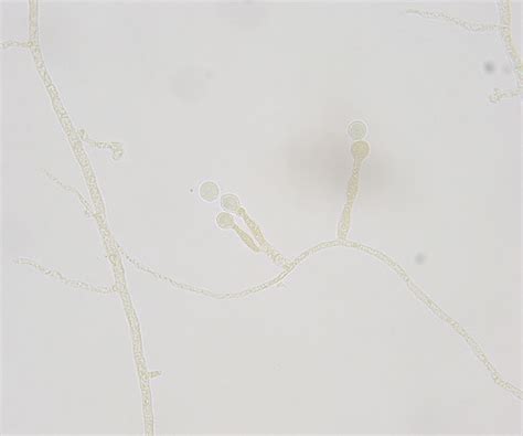 Scopulariopsis Species A Photo On Flickriver