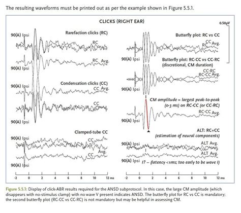Display Of Click Abr Results Required For Ansd Subprotocol Figure 551 Download Scientific