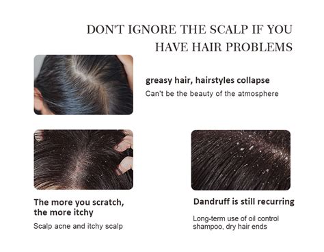 Anti Greasy Scalp Serum Xujohn
