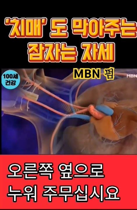 소화가 어렵다거나 역류성식도염 환자는 왼쪽으로 누워자면 위 질환 예방과 소화촉진에 도움된다고 했다 음식이 위에 남아있음 역류
