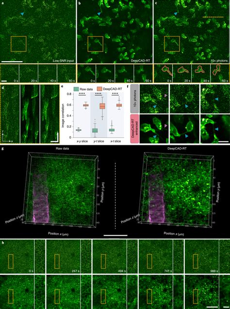 Observing 3d Migration Of Neutrophils In The Mouse Brain In Vivo A
