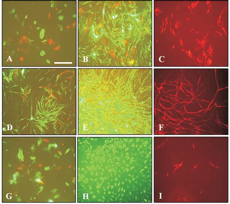 Co Culture Of Human Umbilical Vein Endothelial Cells And Human Pulp