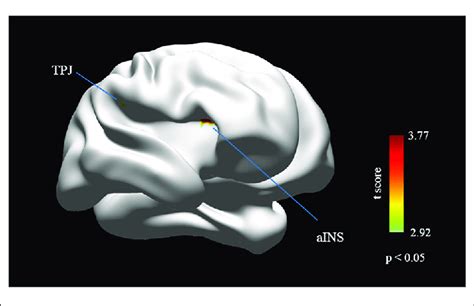 Cortical Areas That Show Significant Correlation Between The