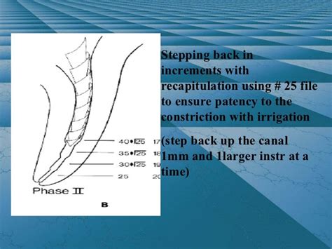 Cleaning And Shaping The Root Canal System