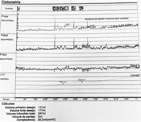 Urodynamic Assessment Showing Detrusor Hyperactivity And Acontractility