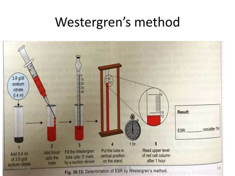 Erythrocyte Sedimentation Rate Esr Ppt