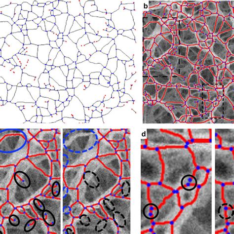 A The Skeleton Image Extracted From The Binary Version Of An Sem Download Scientific Diagram