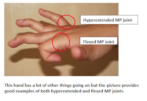 How To Wear And Care For Your Digit Widget A Complete Guide