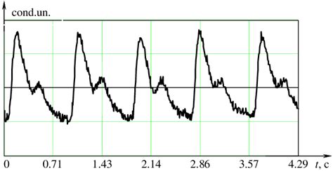 Realization Of The Photoplethysmographic Signal Download Scientific Diagram