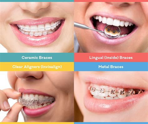 Affordable Teeth Straightening In India Cosmodent India