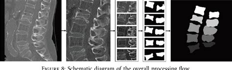Figure 1 From A Spine Segmentation Method Under An Arbitrary Field Of View Based On 3d Swin
