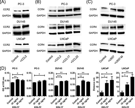 Tumor Associated Macrophages Promote Prostate Cancer Migration Through Activation Of The Ccl22