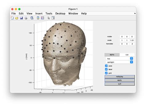 Creating A Fem Volume Conduction Model Of The Head For Source Reconstruction Of Eeg Data