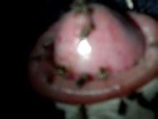 Mosquito Tube Search 92 Videos