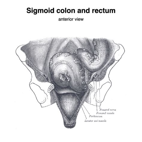 Sigmoid Colon Female Anatomy
