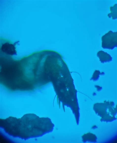 Mealworm This Is Under A Microscope Cant See With Naked Eye Though