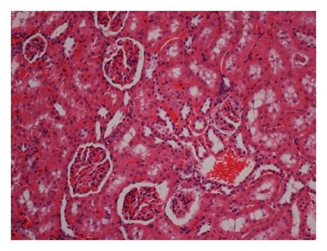 Effect Of Andrographolide On Histological Sections Of The Liver And