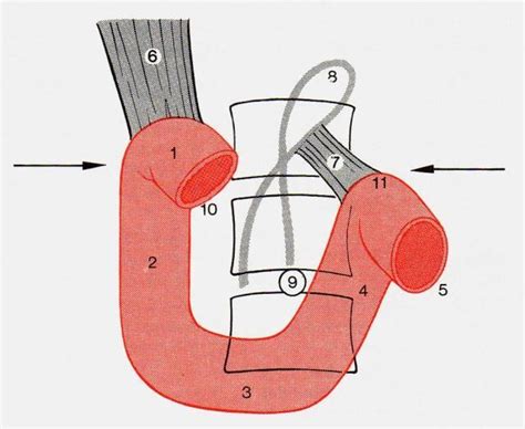 Bulbus Duodeni Nedir Mide Duodenum Filmi Hekimoglu Imaging Center