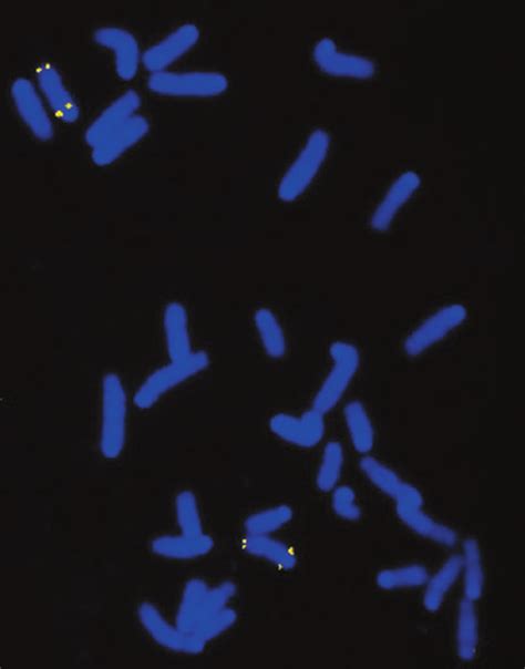 Chromosomal Mapping Of Mouse Mcol A Fluorescent In Situ Hybridization Download Scientific