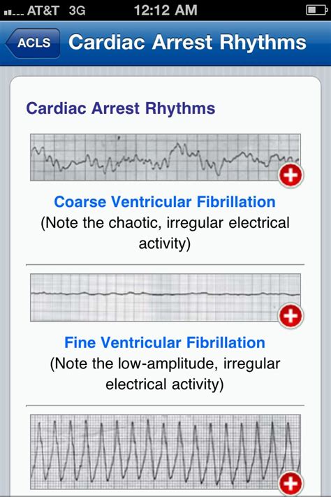 EMS ACLS Guide App Can Deliver Critical Information While In The Field