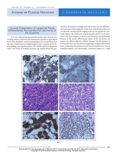 Pdf Unusual Presentation Of Large Cell Poorly Differentiated