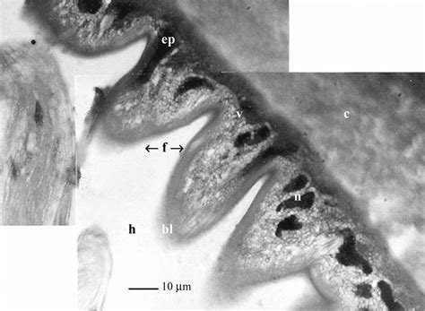 Longitudinal Section Of The Tegument At The Base Of A Scolus Stained