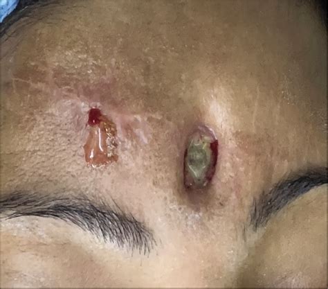 Surgical Neurology International