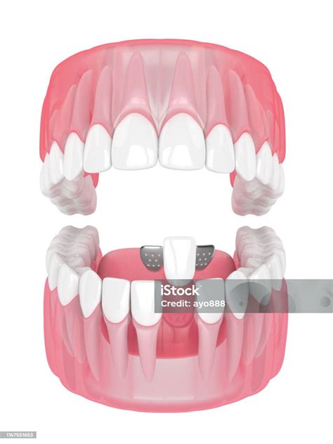 치아와 메릴랜드 다리가있는 턱의 3d 렌더링 교량에 대한 스톡 사진 및 기타 이미지 교량 메릴랜드 주 3차원 형태