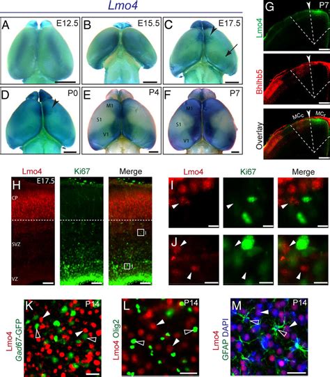 Lmo4 Is Expressed By Postmitotic Neurons In The Rostral Motor Cortex Download Scientific