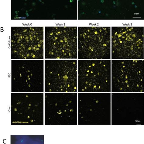 An Overview Of A Typical Joint Structure Hyaline Cartilage The Most