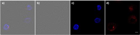 Figure 3 From Light Sheet Fluorescent Microscopy Versus Confocal