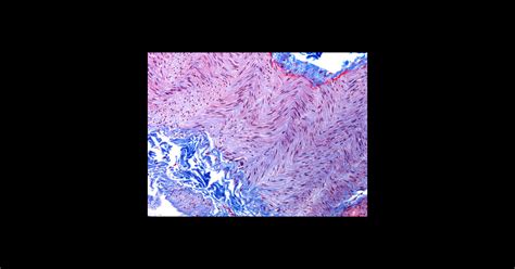 Peripheral Nerve Light Micrograph C022 7315 Axon Sticker Teepublic